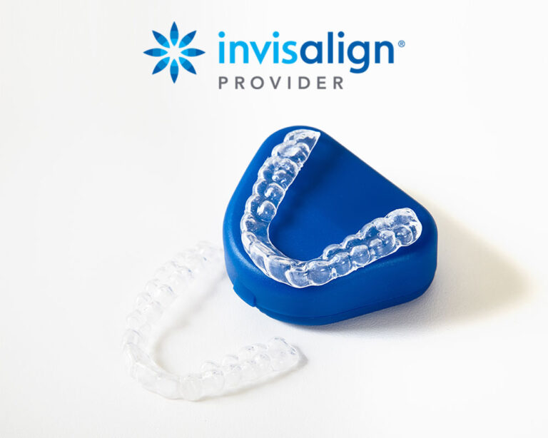 Invisalign | CITIDental South Boston
